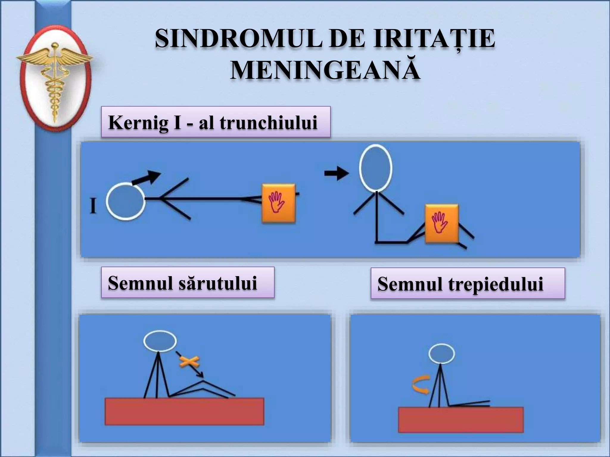 Sindromul de iritatie meningeana | PPTX