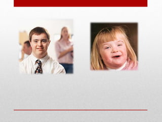 Sindromul down | PPTX