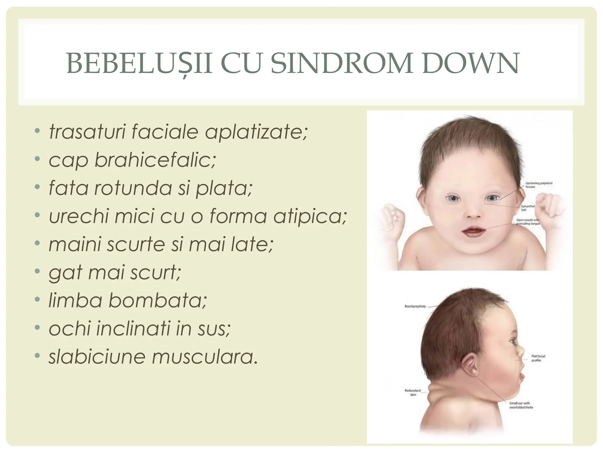 A school project about Down Syndrome Biology | PPTX