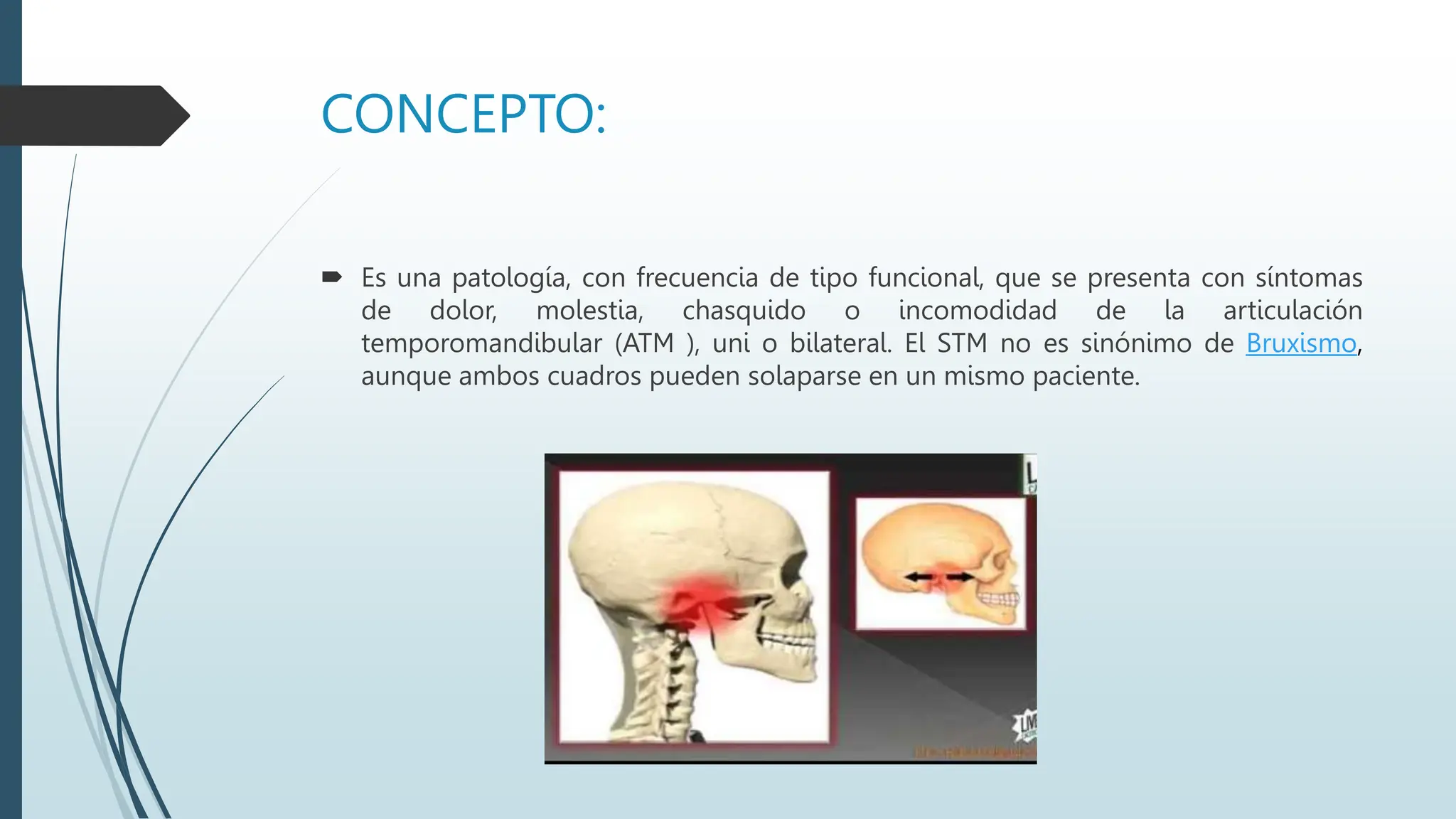 SINDROME DE COSTEN O SINDROME TEMPORO-MANDIBULAR.pptx