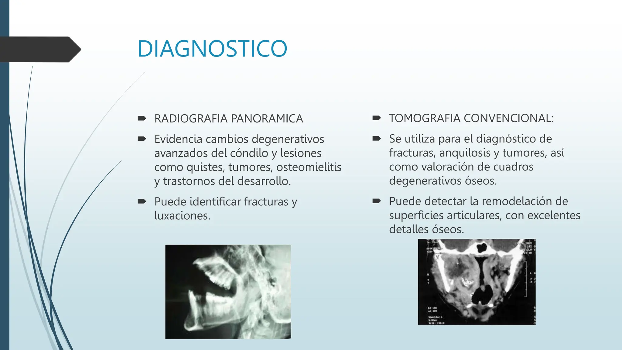 SINDROME DE COSTEN O SINDROME TEMPORO-MANDIBULAR.pptx