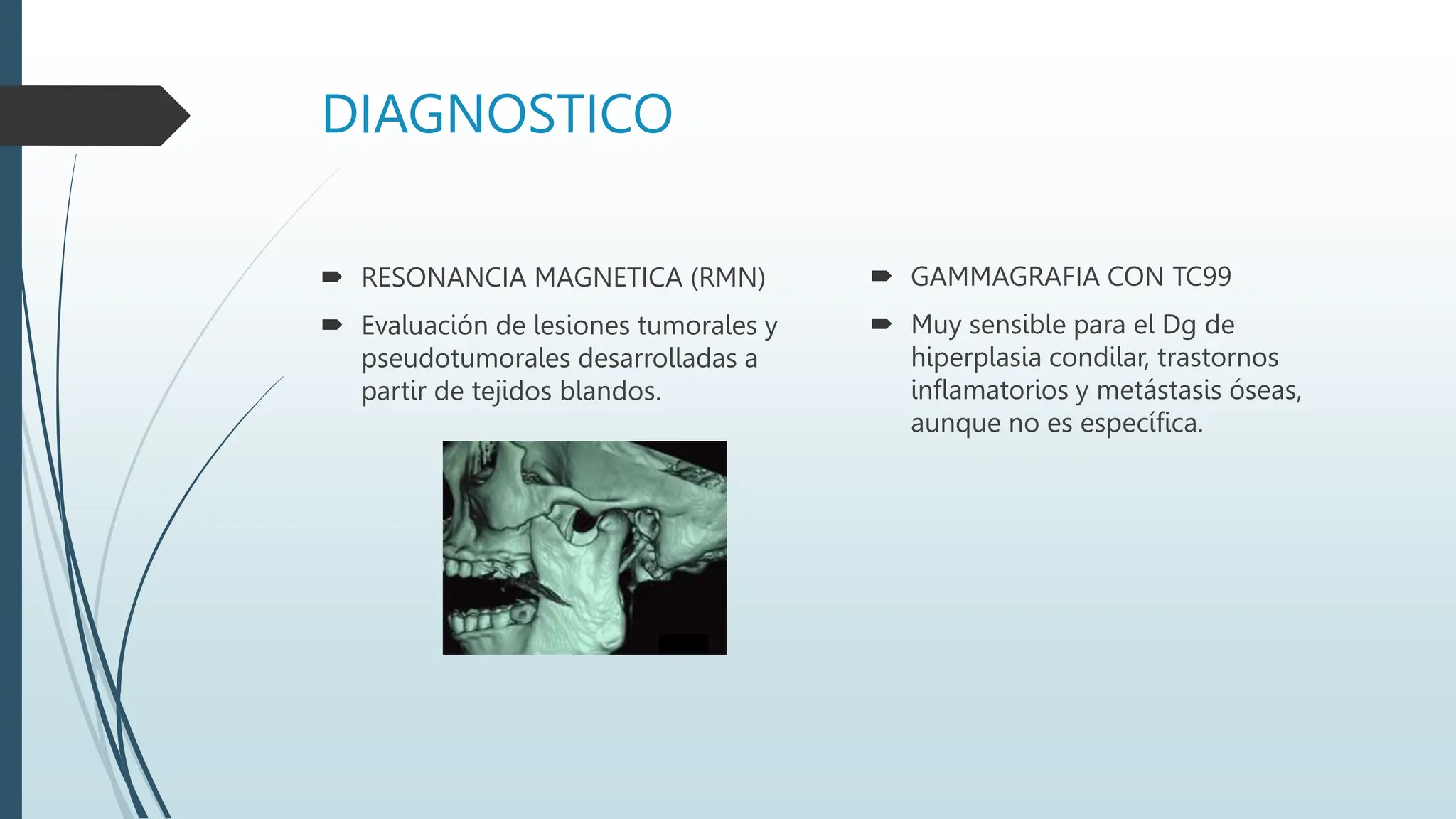 SINDROME DE COSTEN O SINDROME TEMPORO-MANDIBULAR.pptx