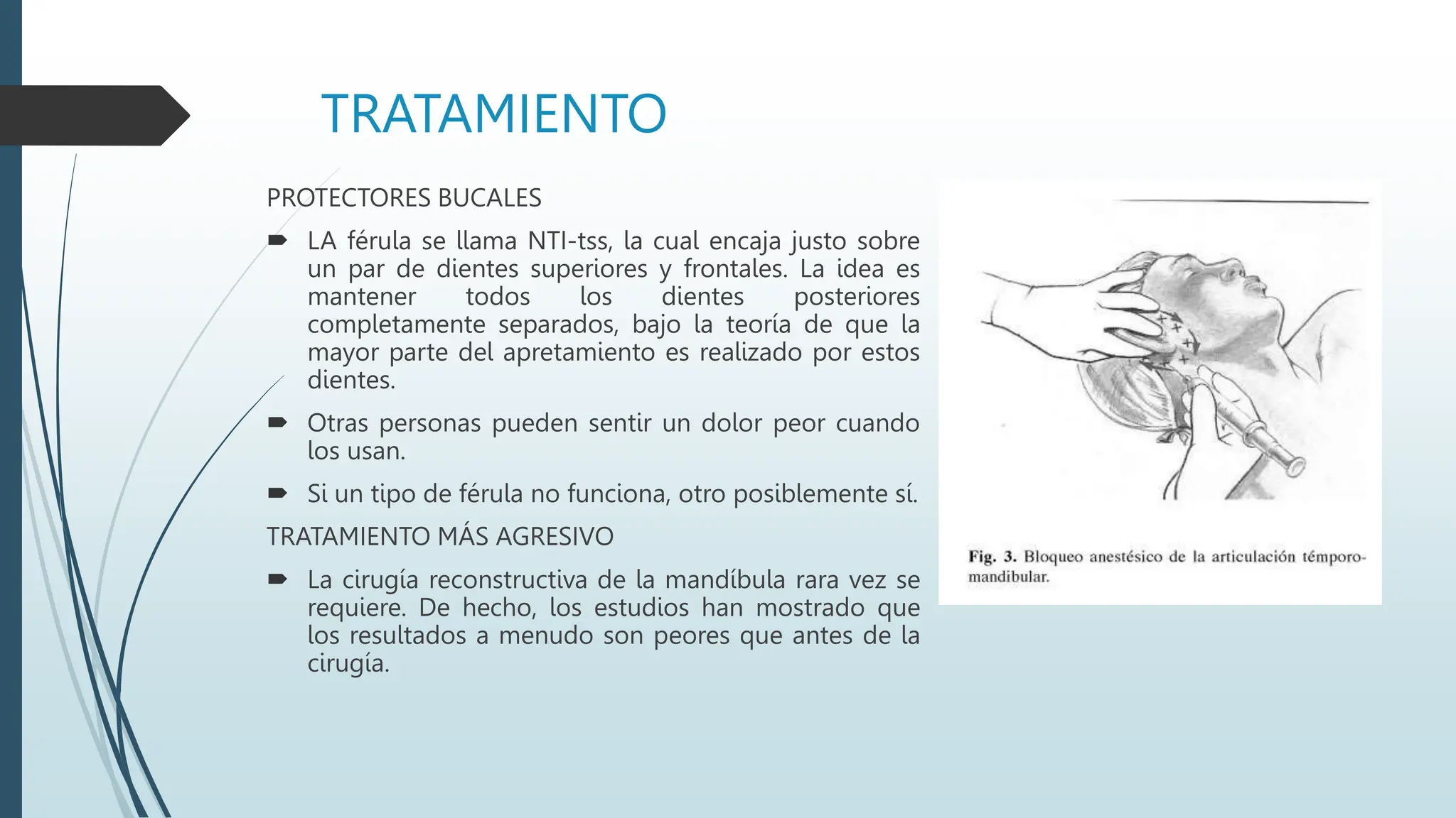 SINDROME DE COSTEN O SINDROME TEMPORO-MANDIBULAR.pptx