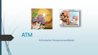 SINDROME DE COSTEN O SINDROME TEMPORO-MANDIBULAR.pptx