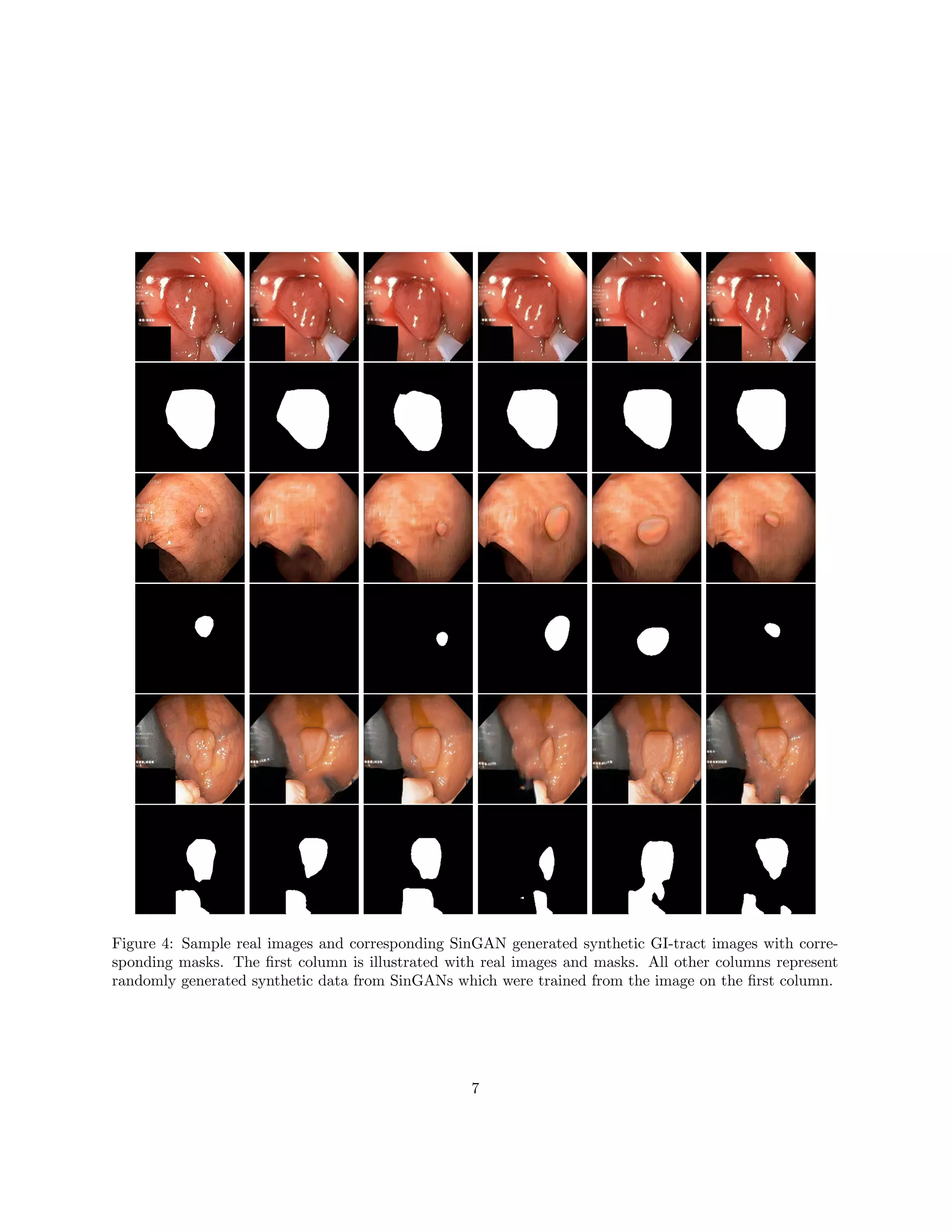 Paper Annotated: SinGAN-Seg: Synthetic Training Data Generation for ...