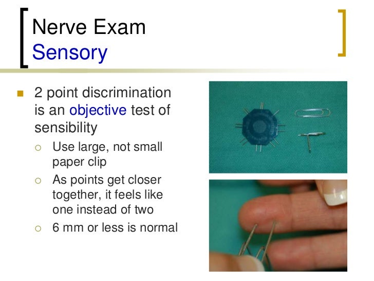 Carpal Tunnel Syndrome