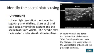 Single-Injection-Caudal-Blocks-for-Pediatric-Anesthesia-7_17.pptx ...