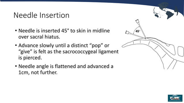 Single-Injection-Caudal-Blocks-for-Pediatric-Anesthesia-7_17.pptx ...