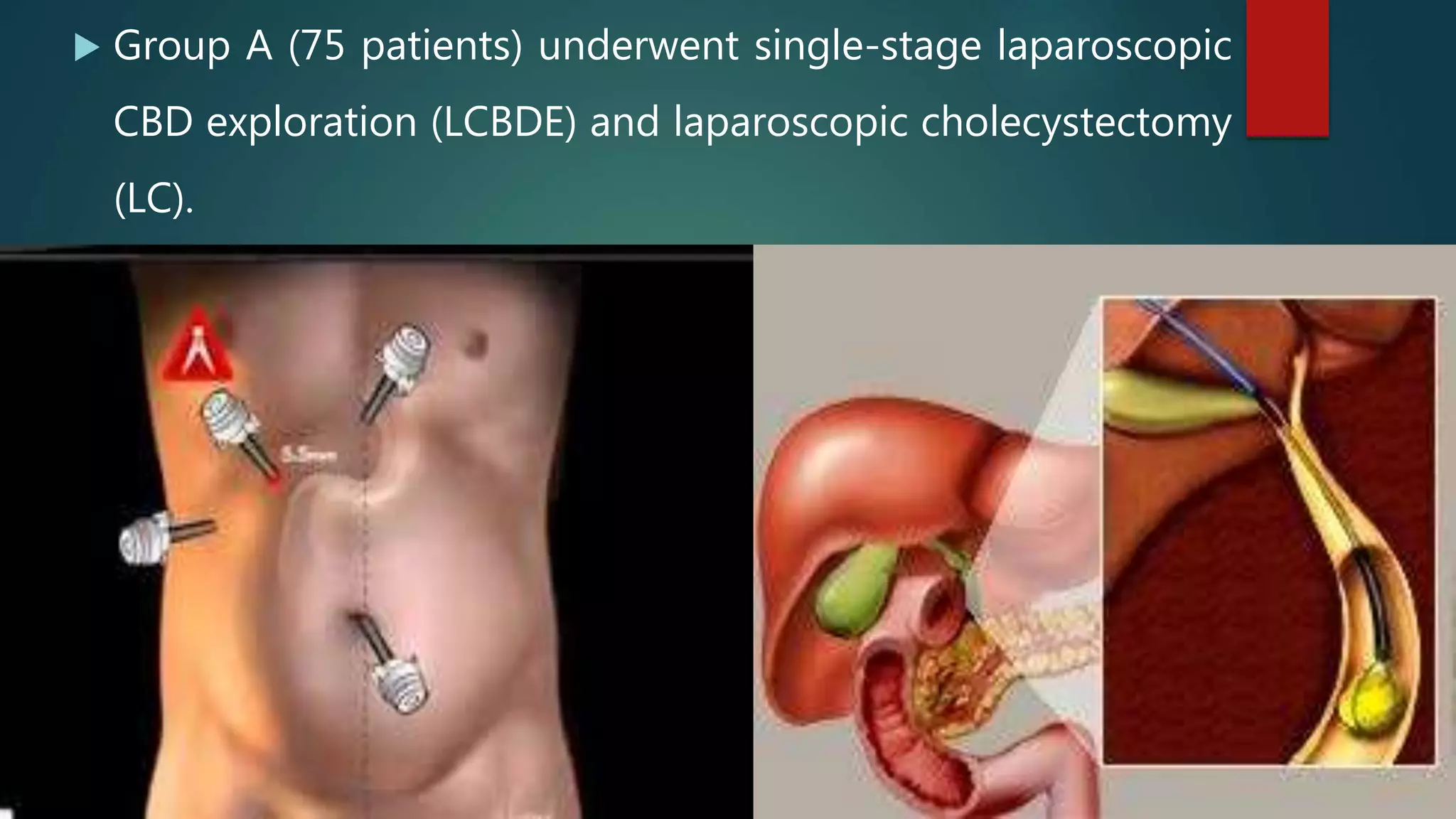 Single stage laparoscopic management for concomitant gallstones and ...