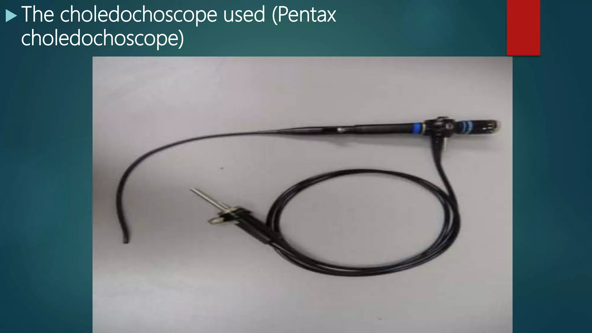 Single stage laparoscopic management for concomitant gallstones and ...