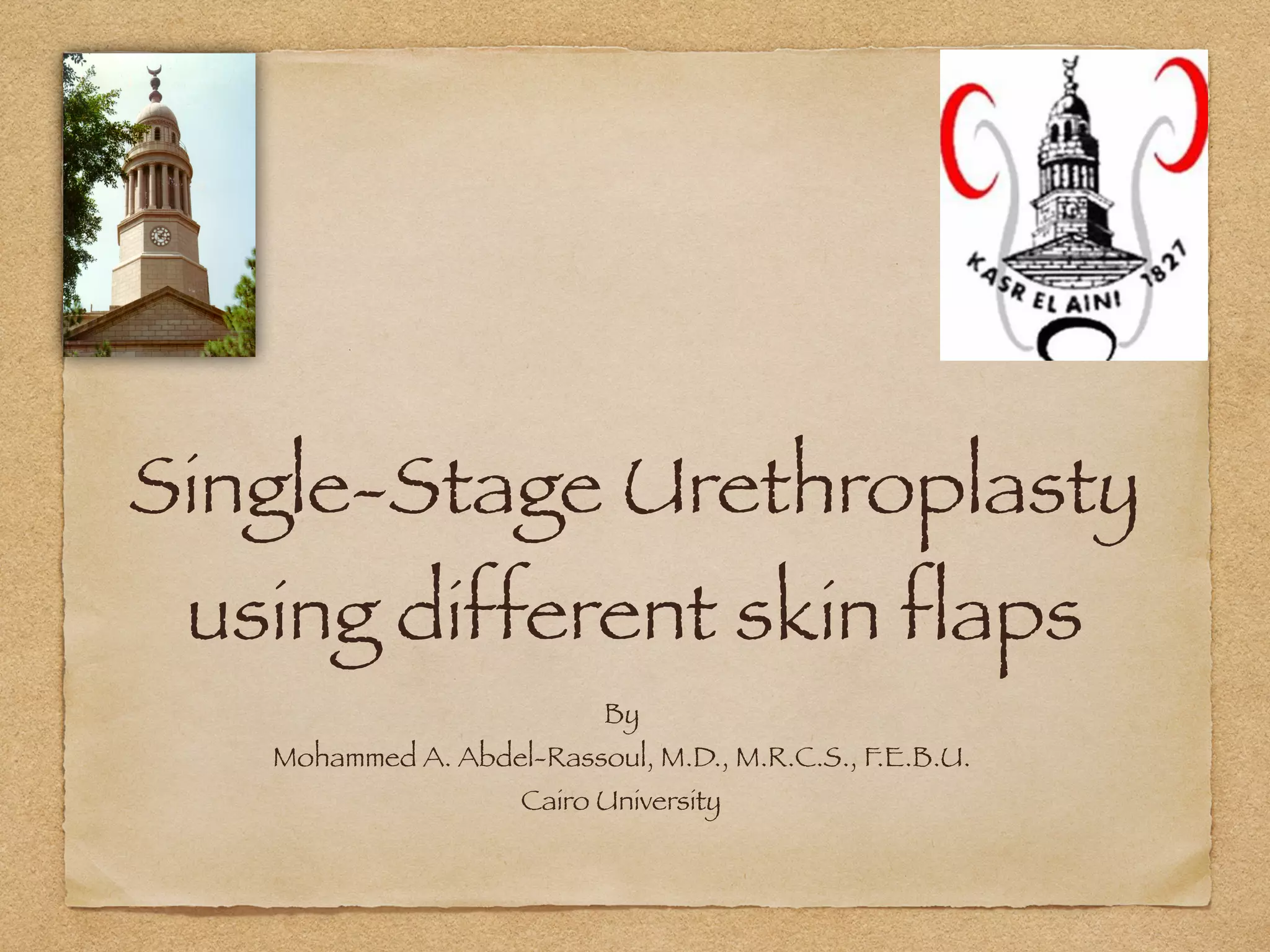 Single stage urethroplasty using penile skin flaps | PDF