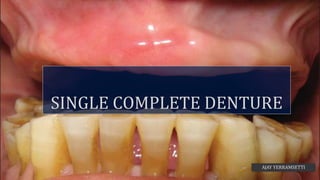 Single complete denture | PPT