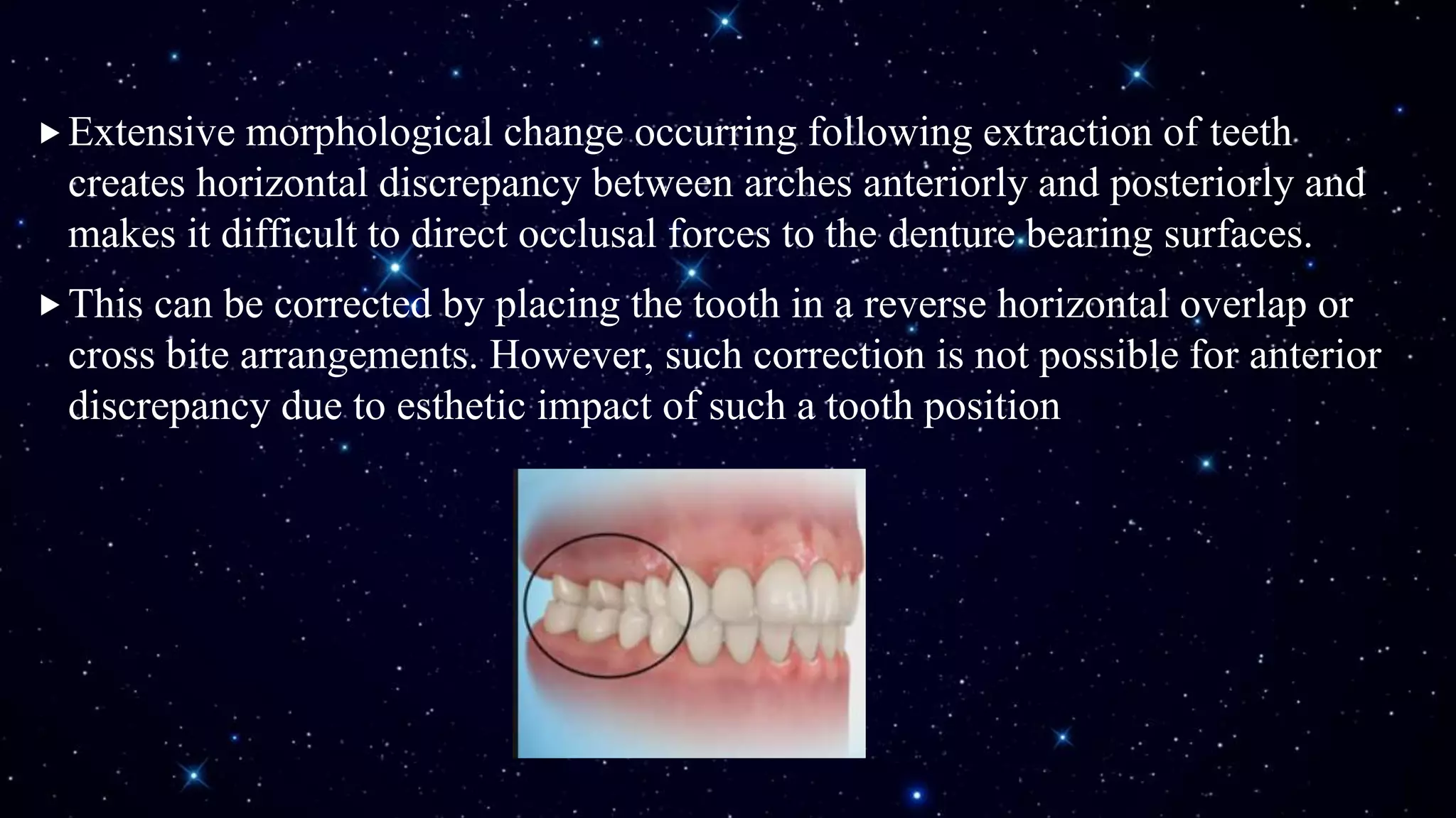 Single complete denture | PPTX