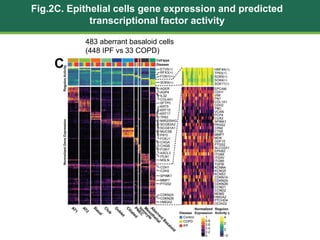 Single-Cell RNAseq in IPF | PPTX
