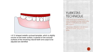 Single complete denture | PPTX