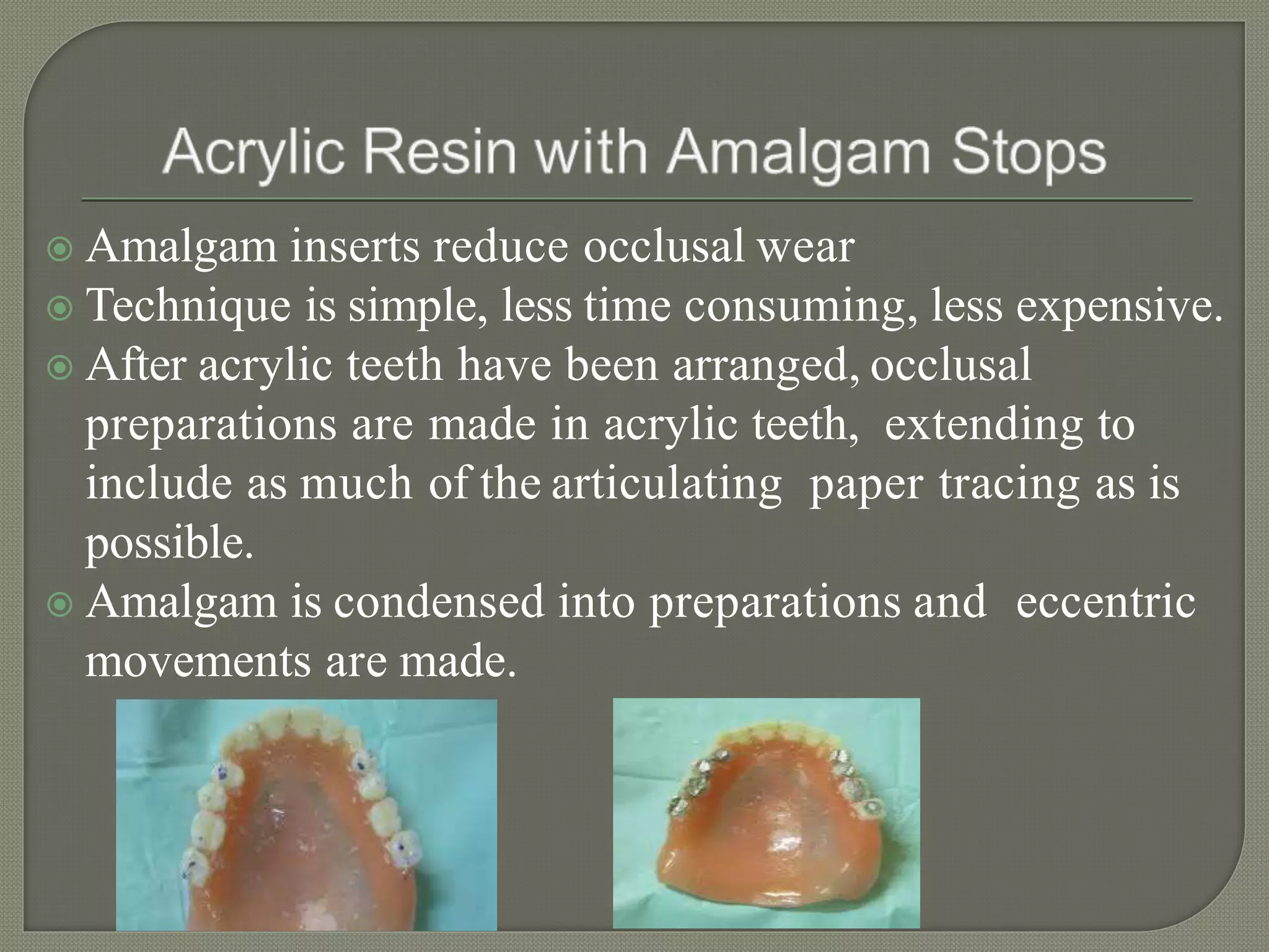 Single complete denture | PPT