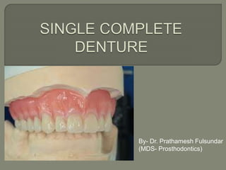 Single complete denture | PPT