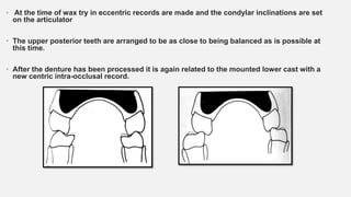 Single complete denture | PPTX