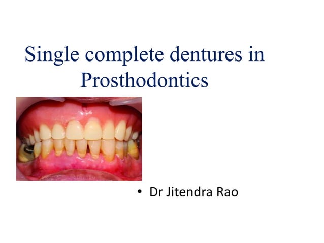 Single_complete_denture prostho1111.pptx