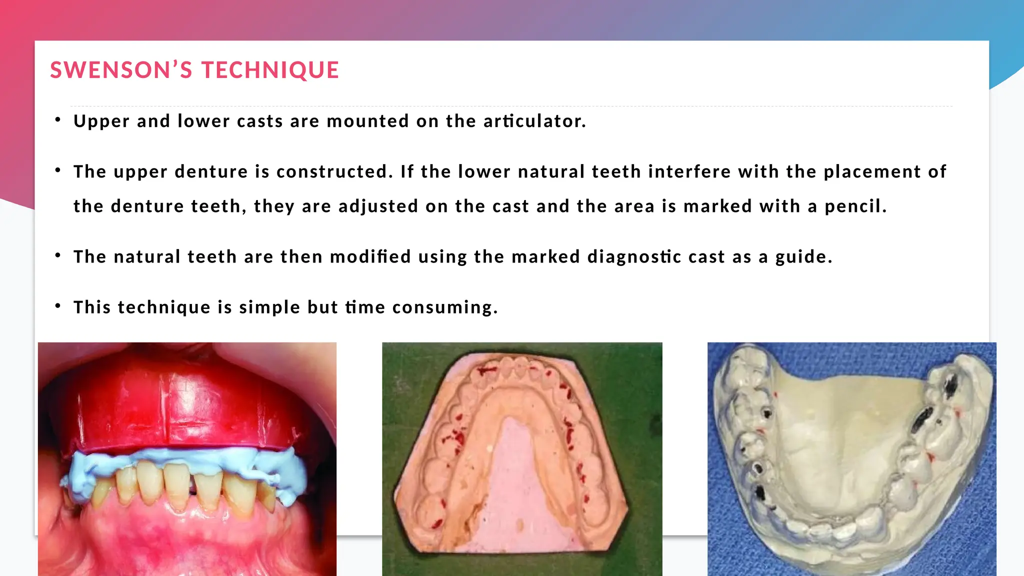 SINGLE COMPLETE DENTURE .pptx
