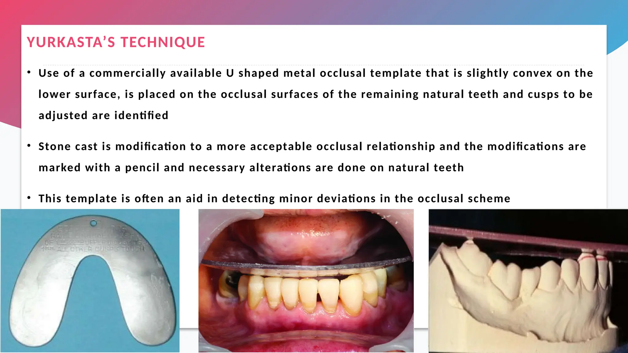 SINGLE COMPLETE DENTURE .pptx