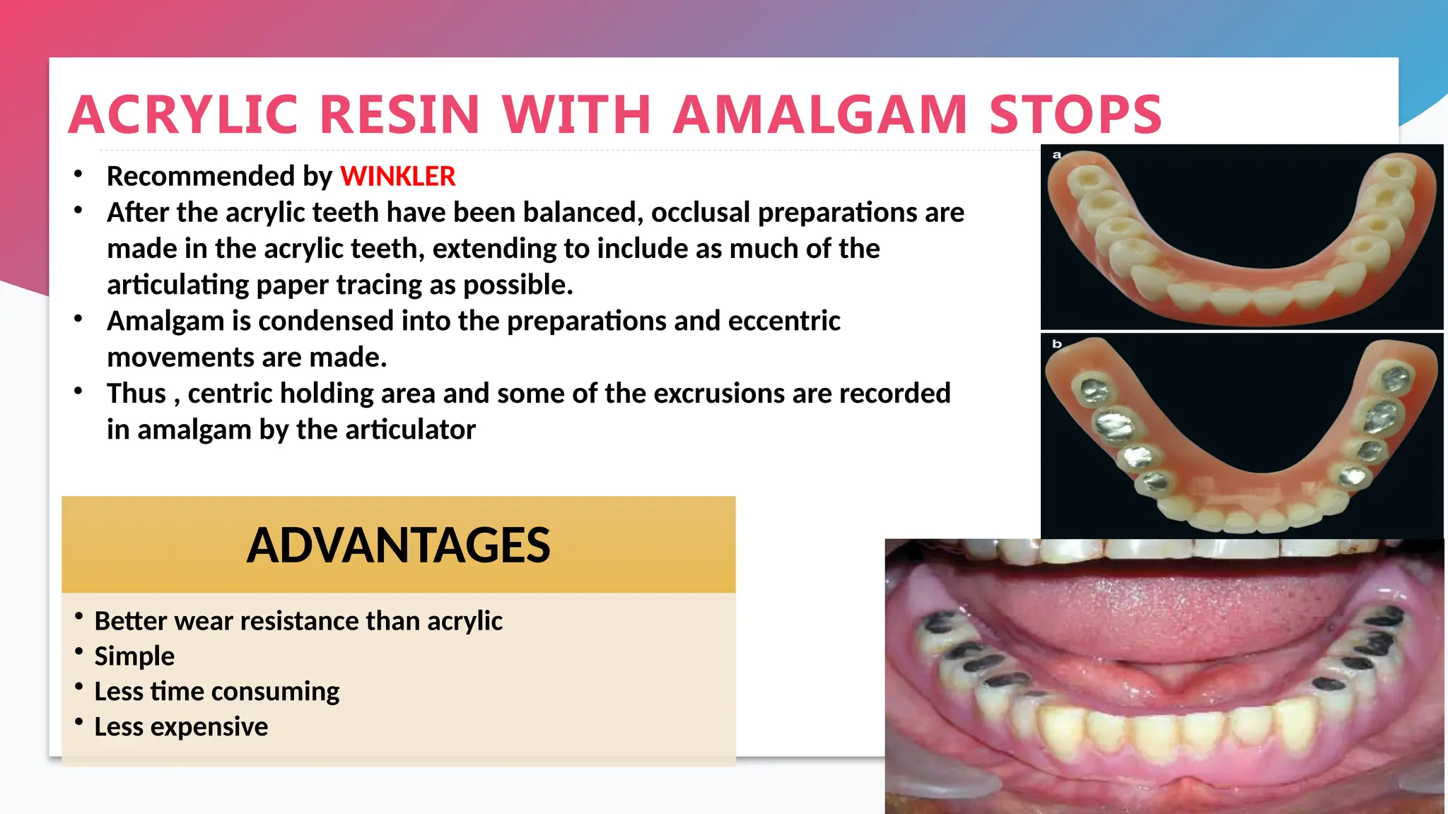 SINGLE COMPLETE DENTURE .pptx