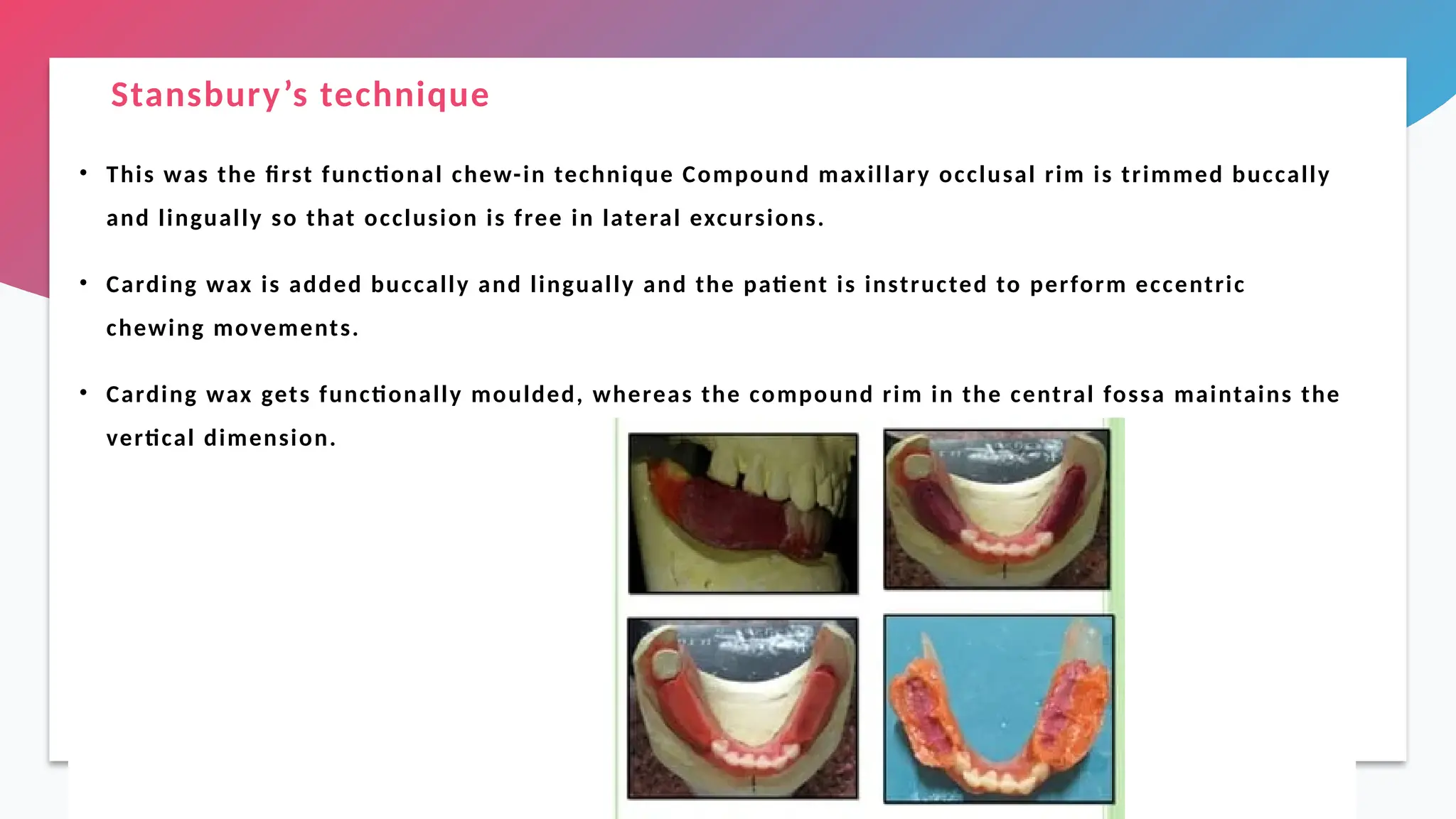 SINGLE COMPLETE DENTURE .pptx