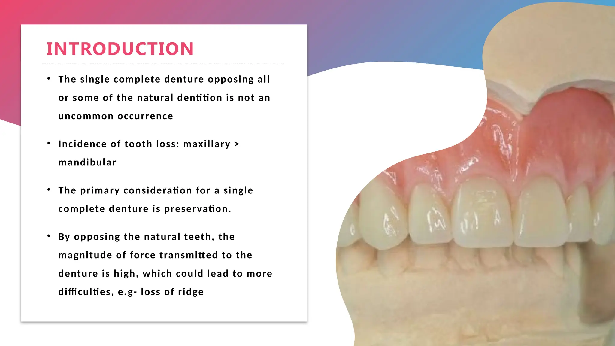 SINGLE COMPLETE DENTURE .pptx