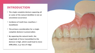 SINGLE COMPLETE DENTURE .pptx
