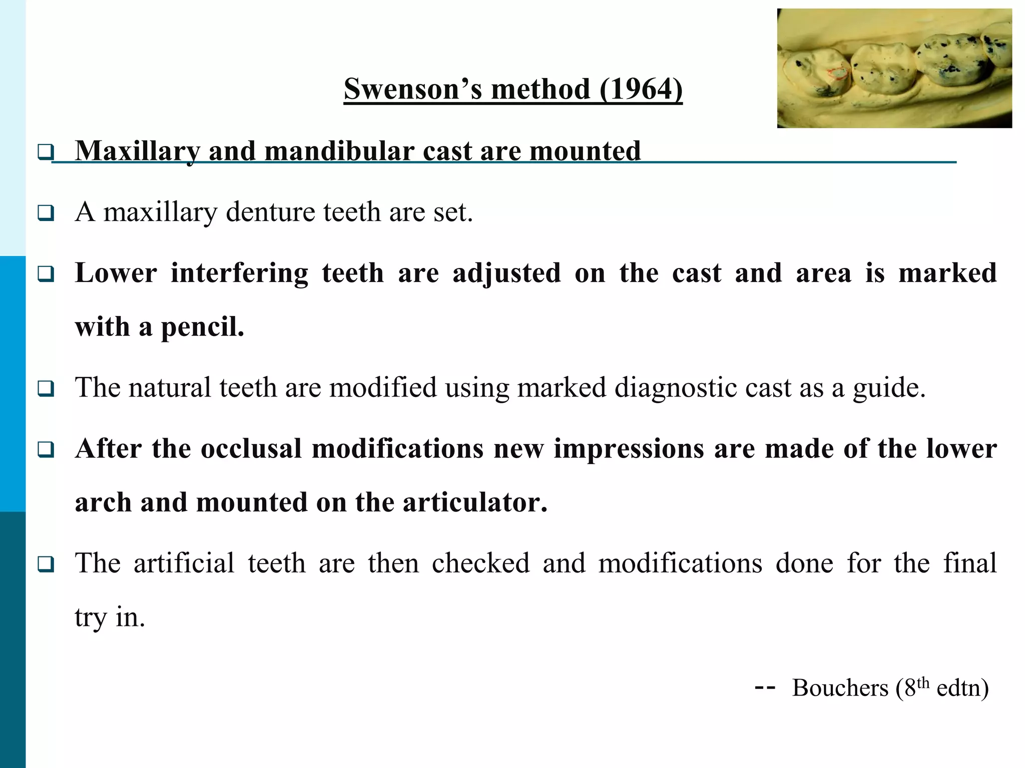 Single complete denture final ppt - copy | PPTX