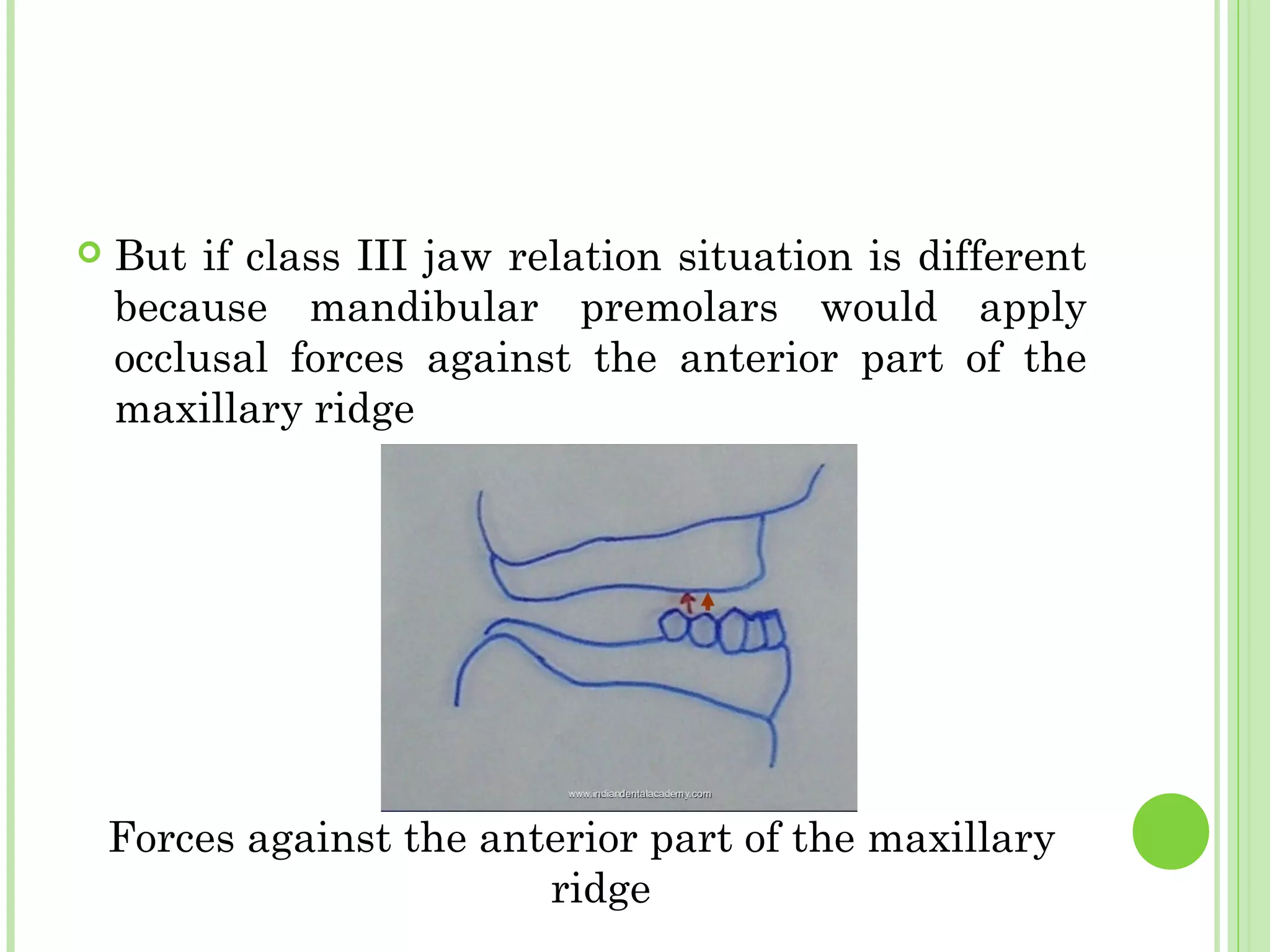 Single Complete Denture | PPT