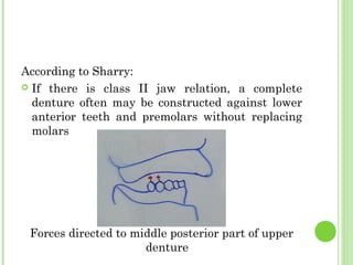Single Complete Denture | PPT