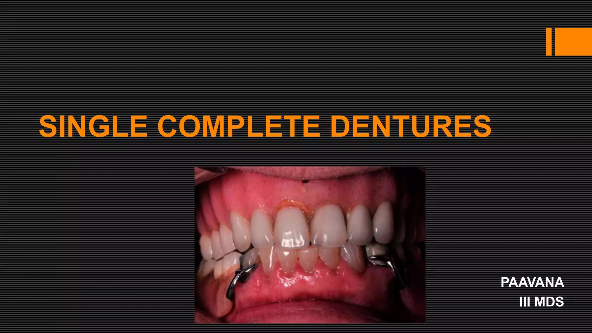 Single complete dentures | PPTX