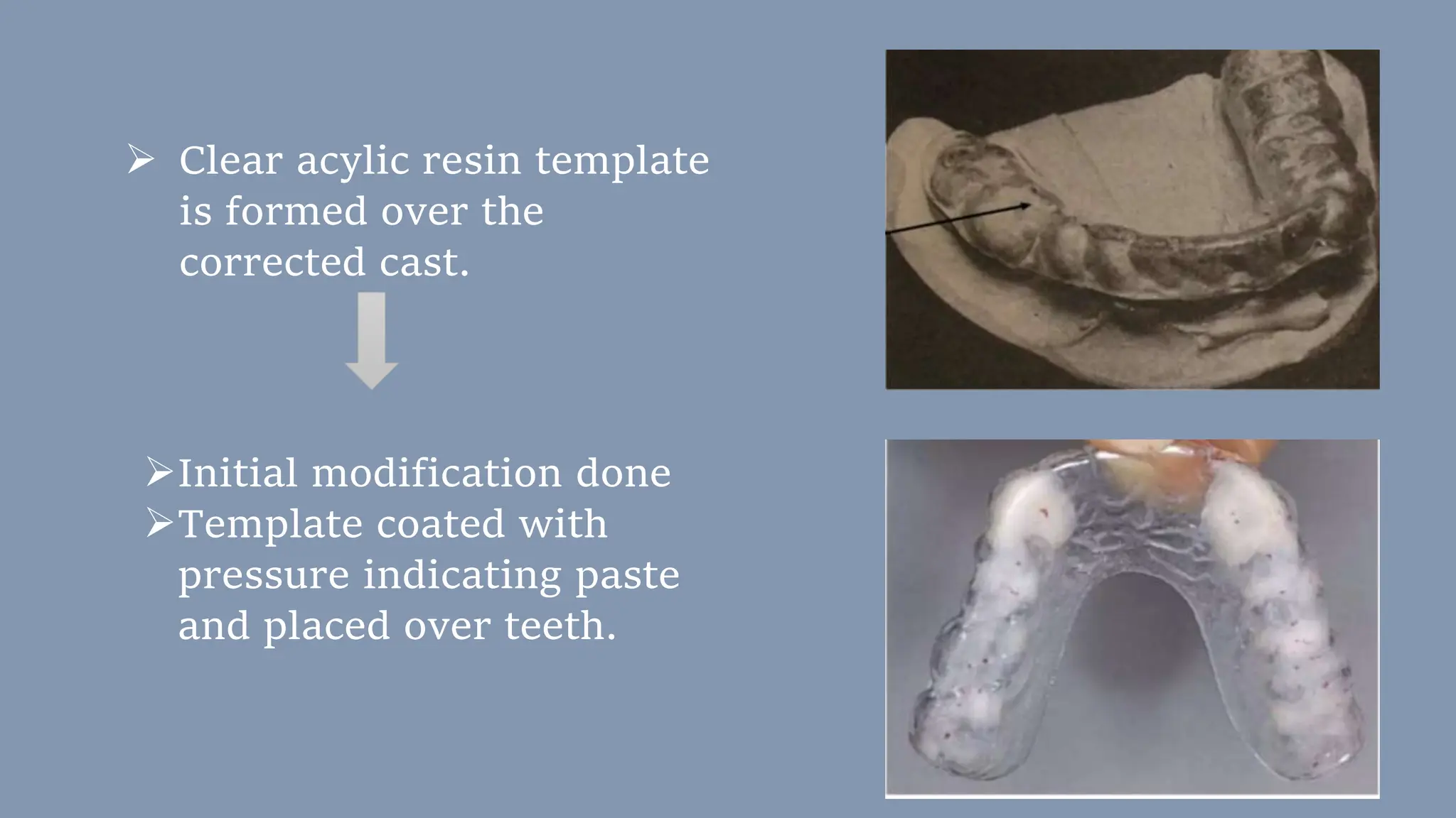 Single Complete Dentures.pptx