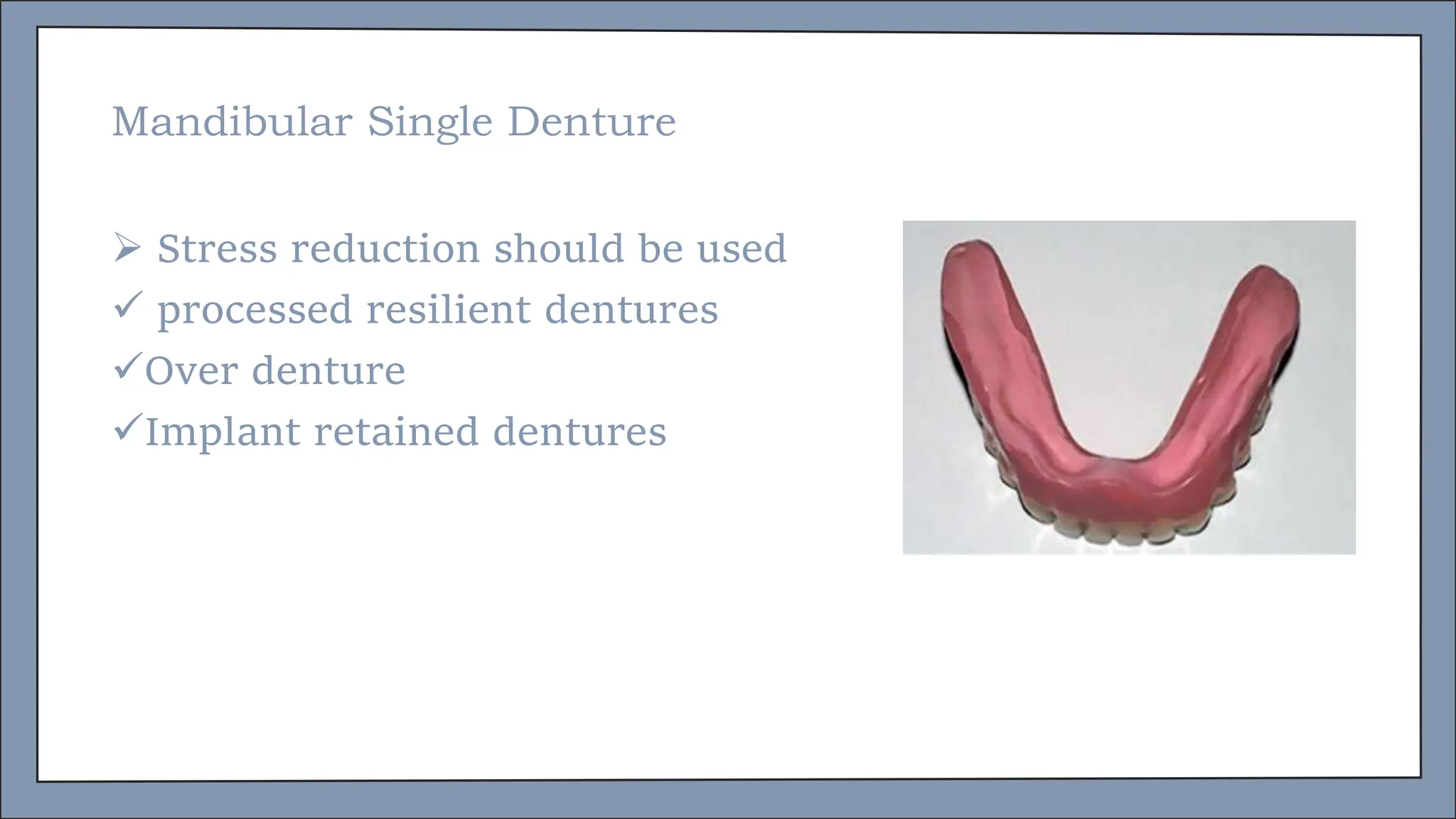 Single Complete Dentures.pptx