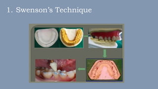 Single Complete Dentures.pptx