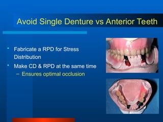 Single Complete Dentures (1).ppt dental | PPT