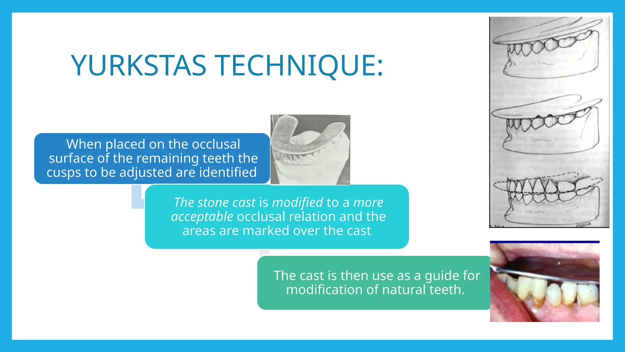 SINGLE COMPLETE DENTURES sam [Autosaved] (1).pptx