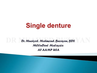 Single denture | PPTX