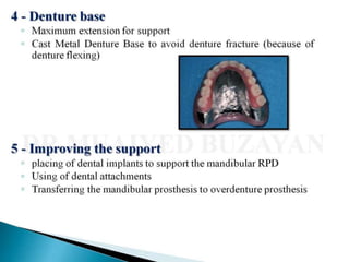Single denture | PPTX