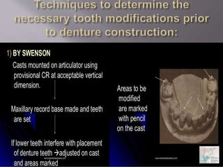 Single denture | PPT