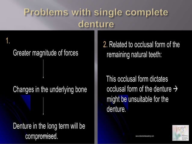 Single denture | PPTX