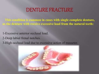 Single denture construction technique | PPTX