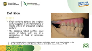 Key point of Single complete denture ppt | PPTX