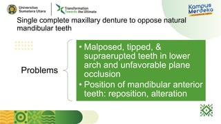 Key point of Single complete denture ppt | PPTX