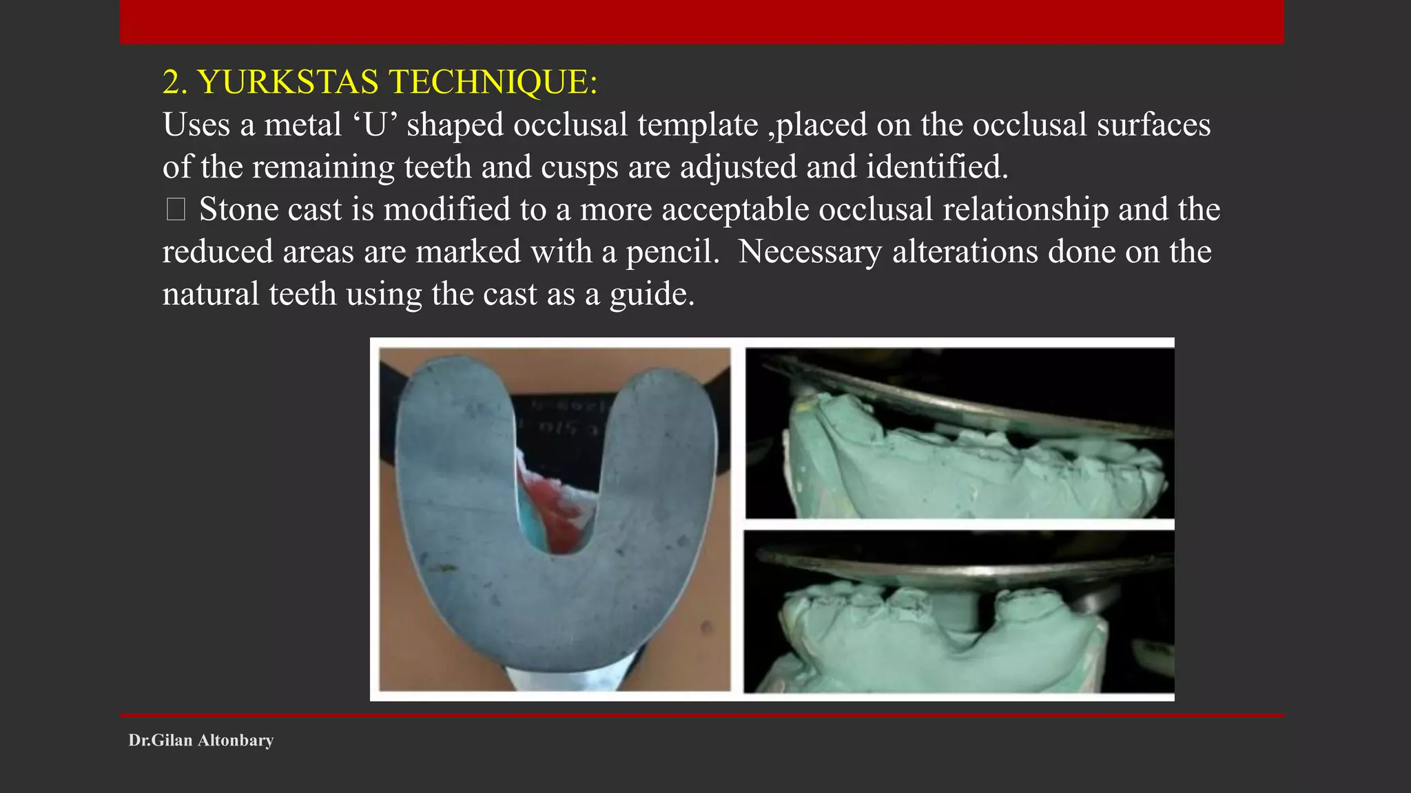 single denture kelly syndrome.pdf