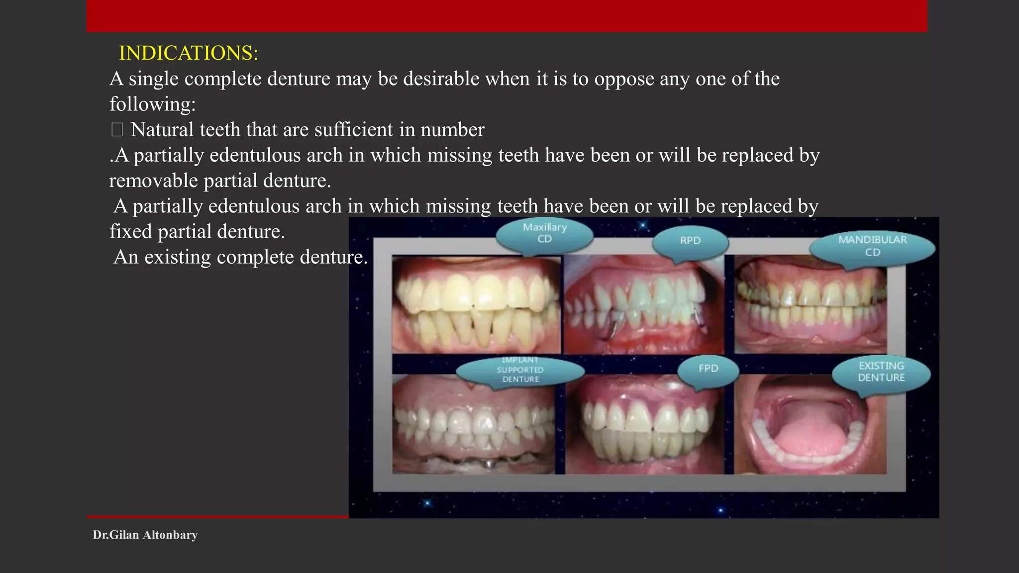 single denture kelly syndrome.pdf