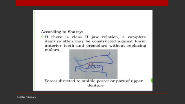 single denture kelly syndrome.pdf