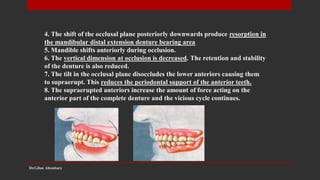 single denture kelly syndrome.pdf