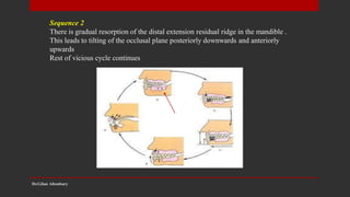 single denture kelly syndrome.pdf